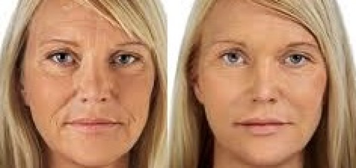 Structure chimique de l’acide hyaluronique – Tout sur l'Acide Hyaluronique